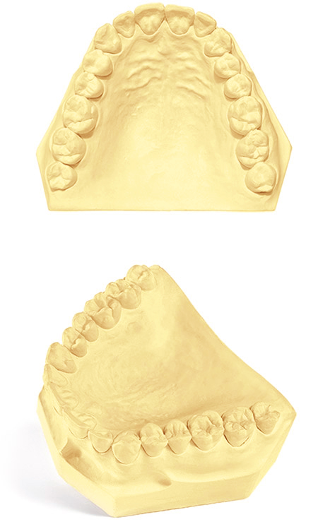 PRISTINE III – Garreco™ Dental Lab Products